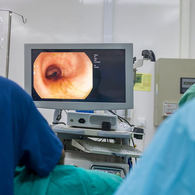 Preventing biofilms in IBS - Institute for Molecular Bioscience ...