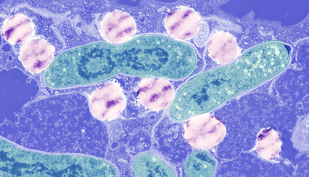 Fats fighting back against bacteria - Institute for Molecular ...