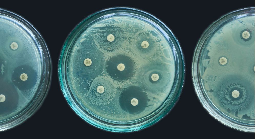 How do bacteria actually become resistant to antibiotics? - Institute ...